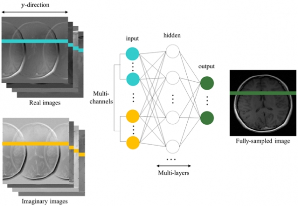 KAIST, MRI 촬영시간 단축기술 개발